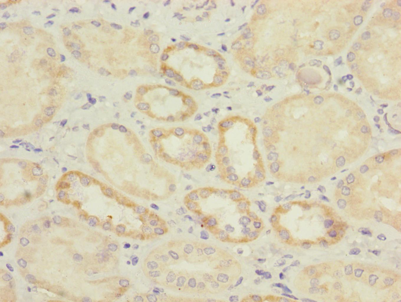 IL17RB Antibody (PA5-98965)