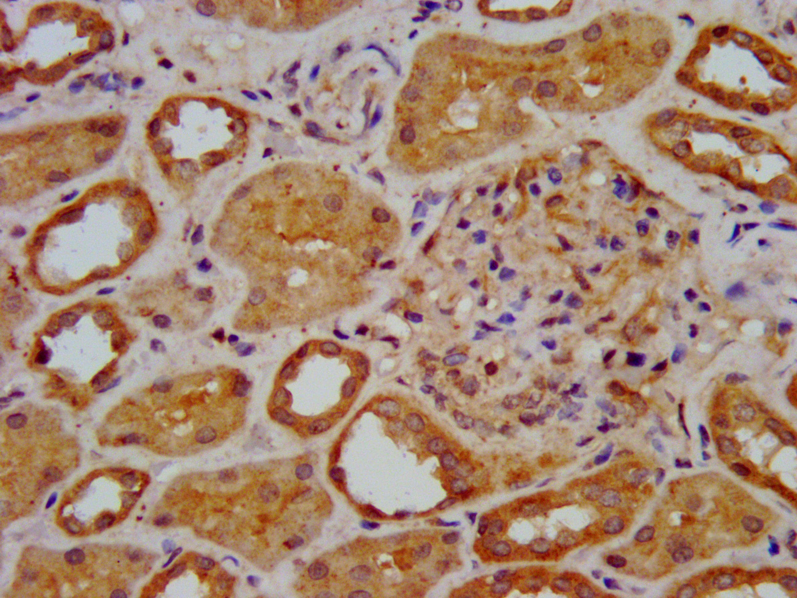 ELP3 Antibody (PA5-98993)