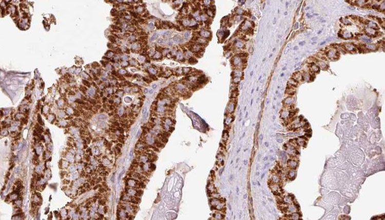 Caspase 1 p20 (Cleaved Asp296) Antibody (PA5-99390)