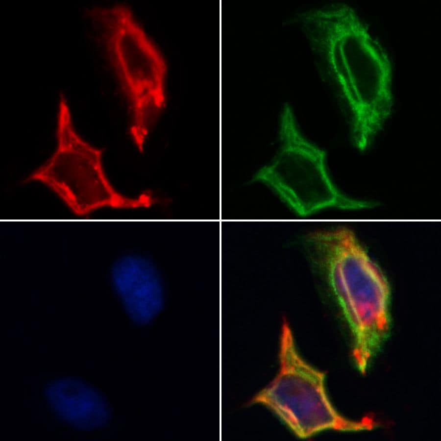 ITGA3 Antibody (PA5-99407)