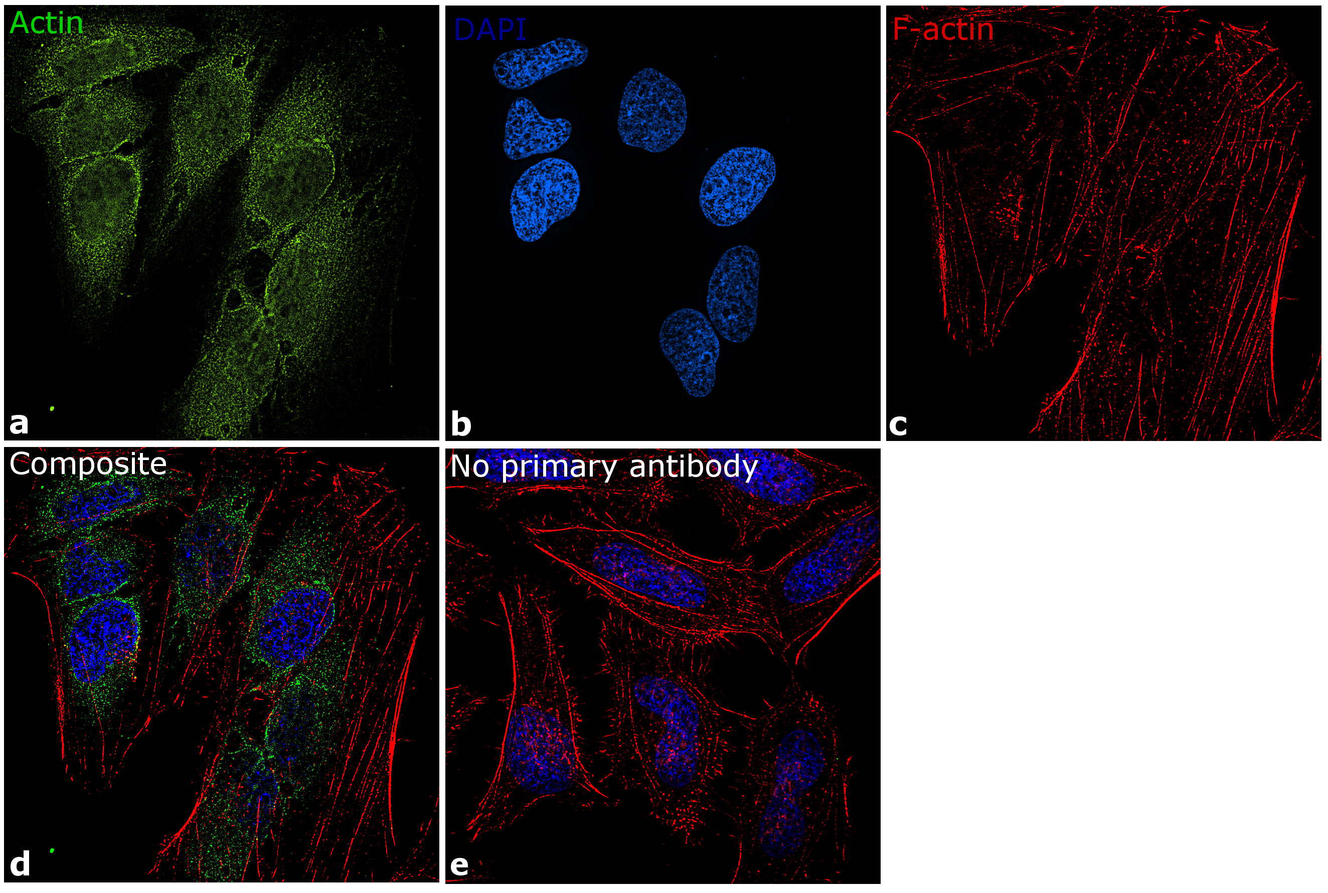 Actin Antibody (PA5-11570)
