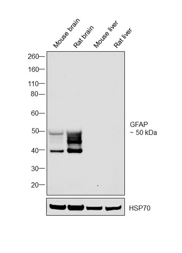 GFAP Antibody (PA5-16291)