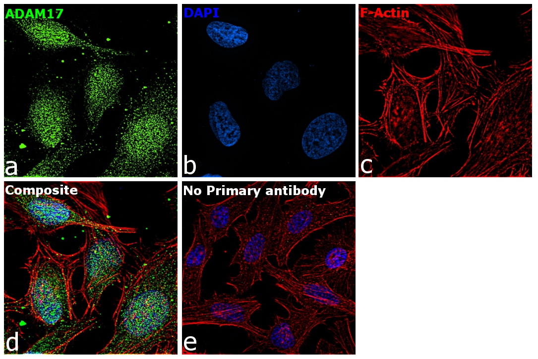 ADAM17 Antibody (PA5-17079)