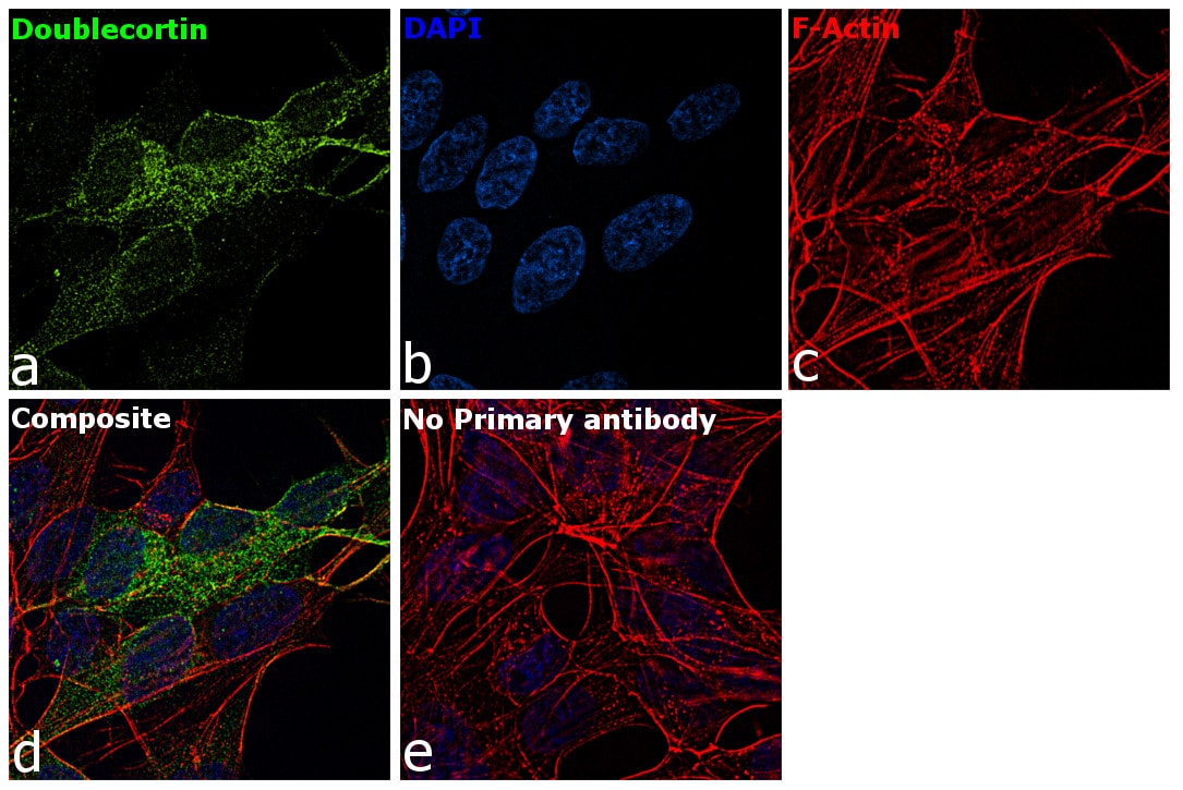 Doublecortin Antibody (PA5-17428)
