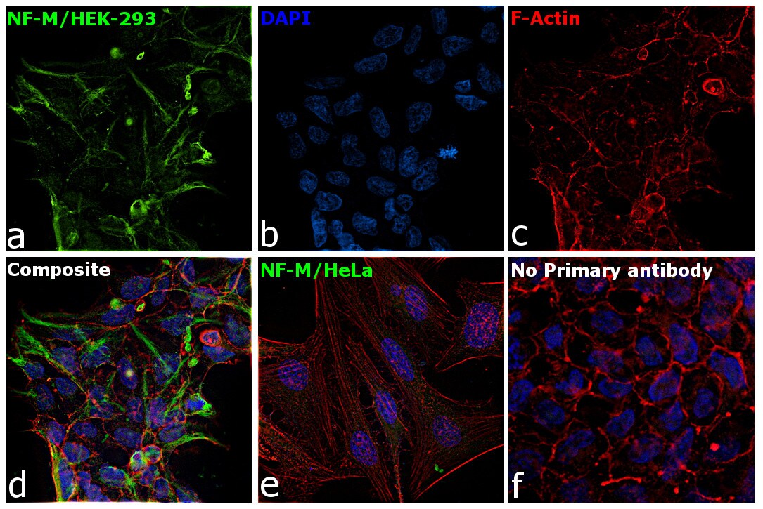 NEFM Antibody (PA5-19200)