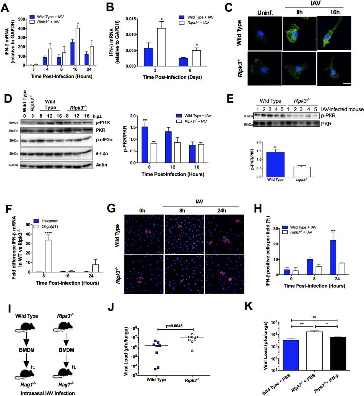 IFN beta Antibody (PA5-20390)