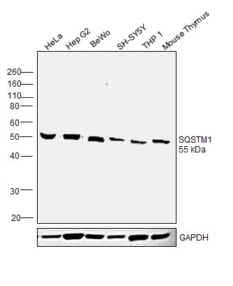 SQSTM1 Antibody (PA5-20839)