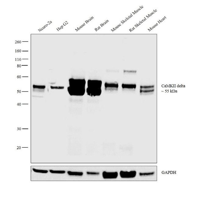 CaMKII delta Antibody (PA5-22168)