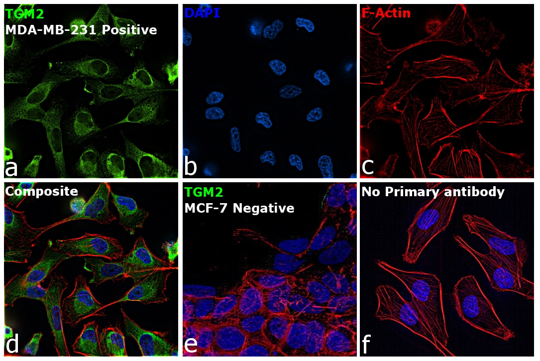 TGM2 Antibody (PA5-23219)