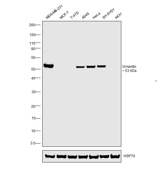 Vimentin Antibody (PA5-27231)