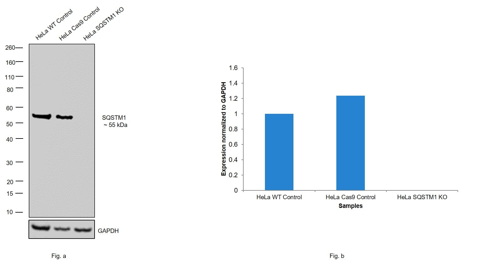 SQSTM1 Antibody (PA5-27247)