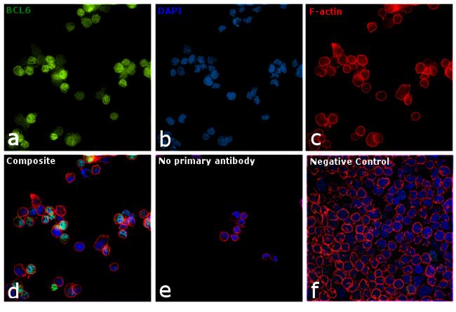 BCL6 Antibody (PA5-27390)