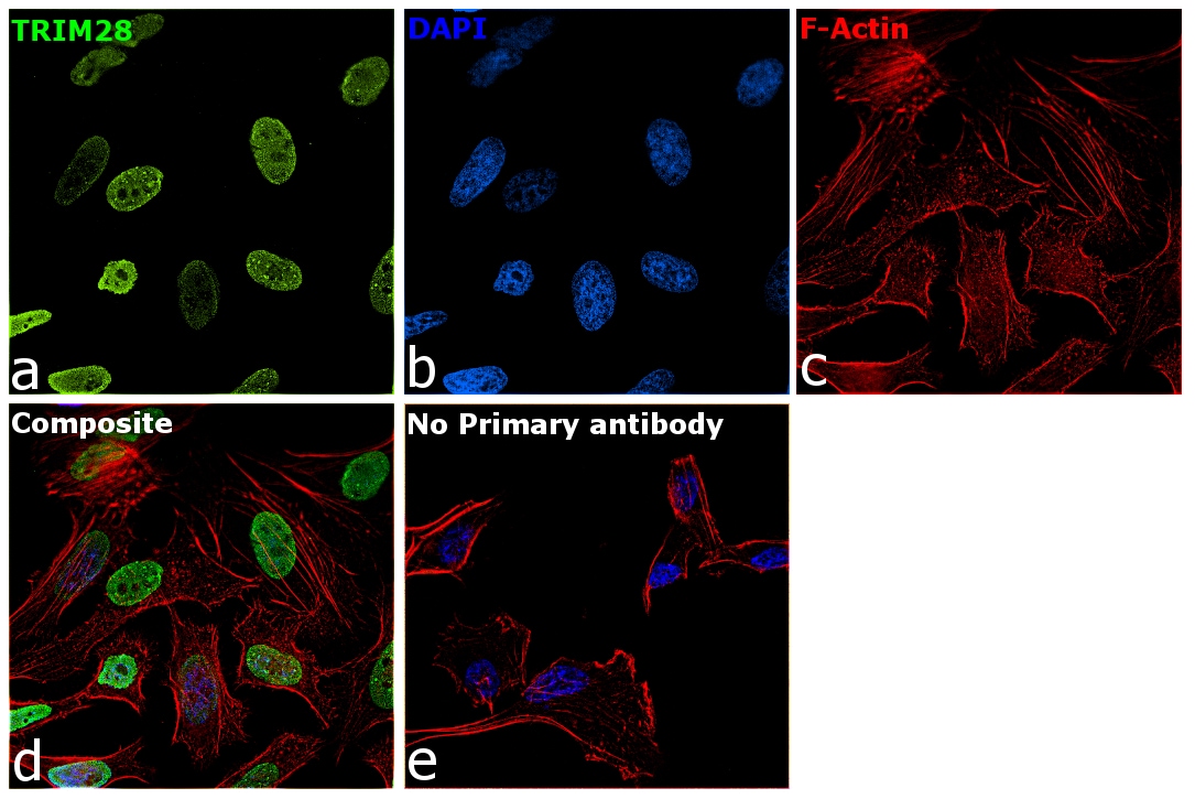 TRIM28 Antibody (PA5-27648)