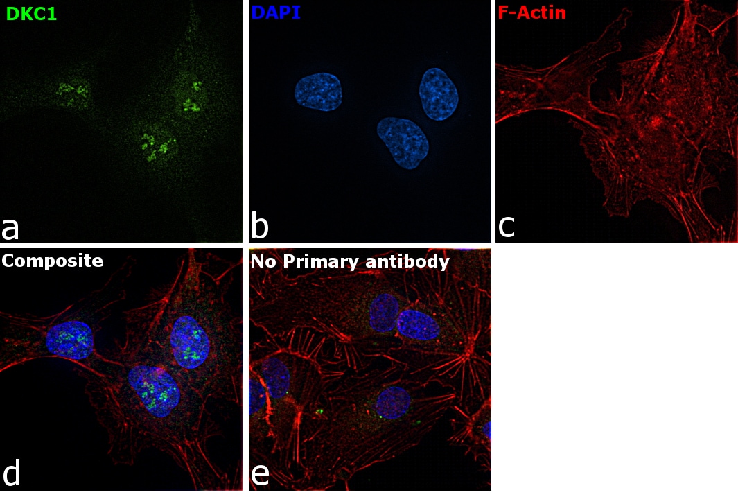 DKC1 Antibody (PA5-28922)