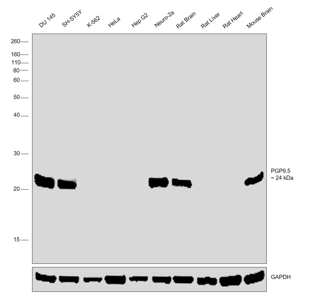 PGP9.5 Antibody (PA5-29012)