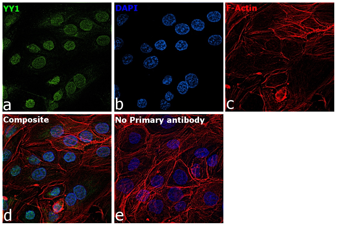 YY1 Antibody (PA5-29171)