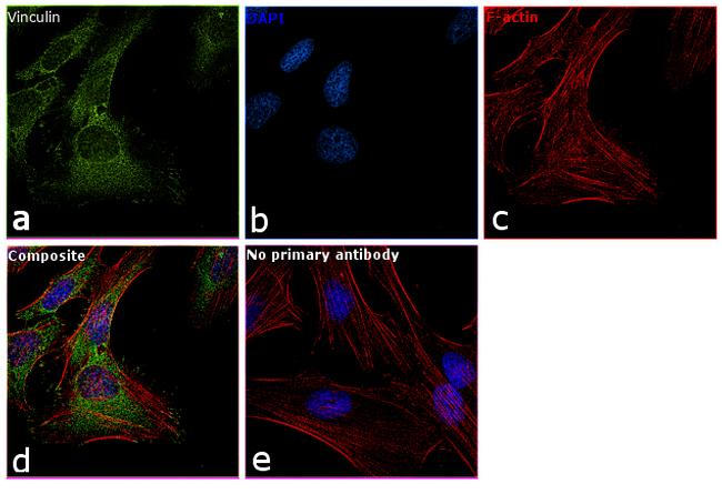Vinculin Antibody (PA5-29688)