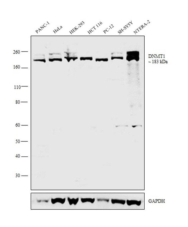 DNMT1 Antibody (PA5-30581)