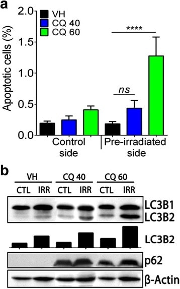 LC3B Antibody (PA5-32254)