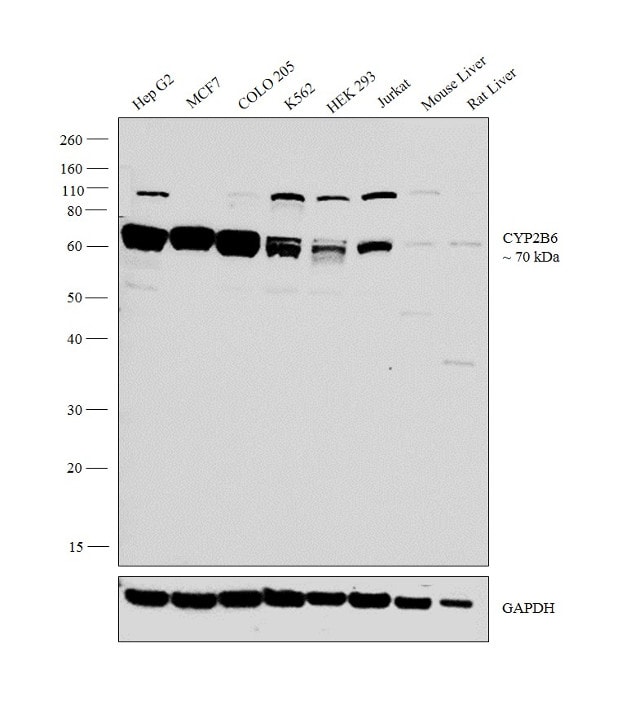 CYP2B6 Antibody (PA5-35032)