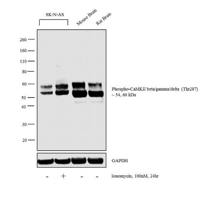 Phospho-CaMKII beta/gamma/delta (Thr287) Antibody (PA5-37833)