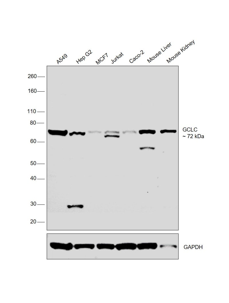 GCLC Antibody (PA5-44190)