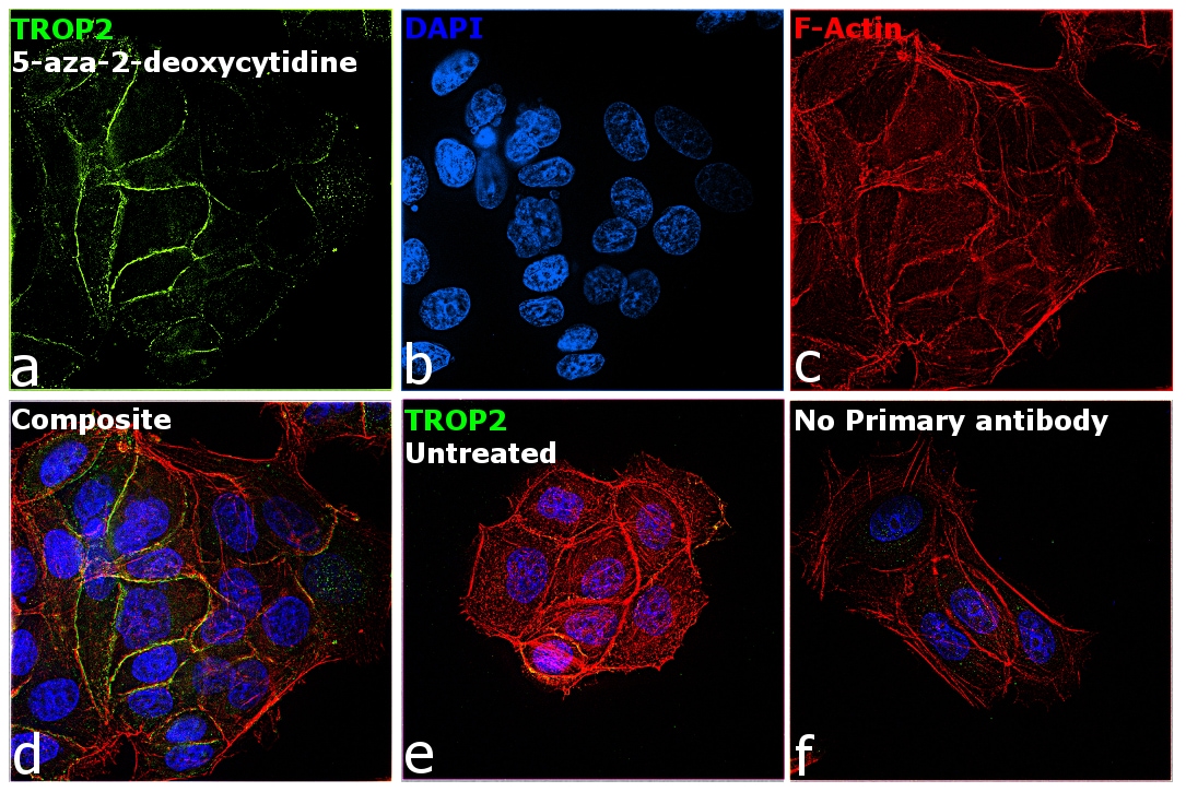 TROP2 Antibody (PA5-47030)