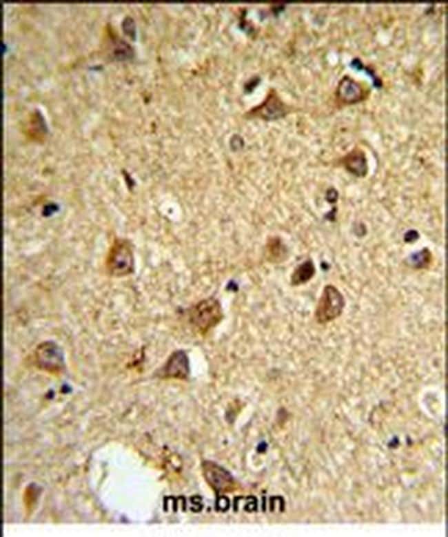 DIO2 Antibody (PA5-49631)