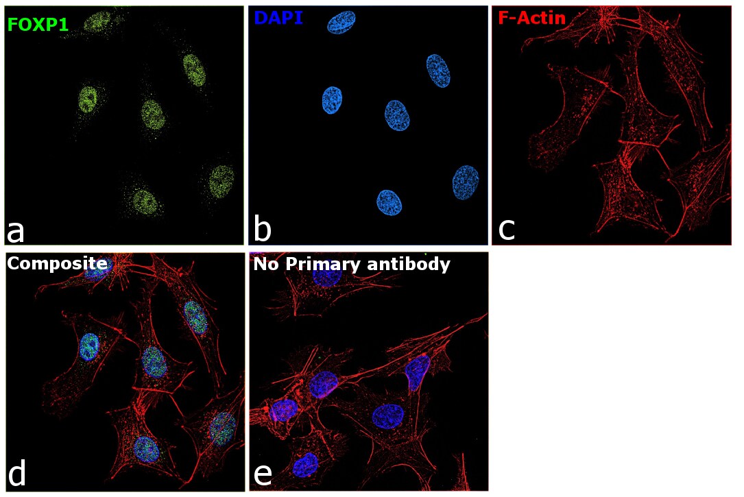 FOXP1 Antibody (PA5-52006)