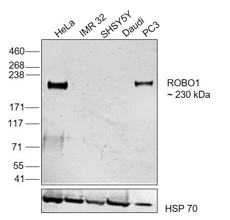 ROBO1 Antibody (PA5-65752)