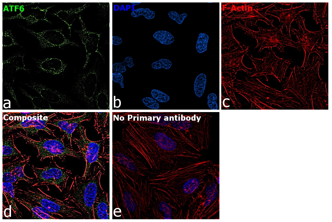 ATF6 Antibody (PA5-68556)