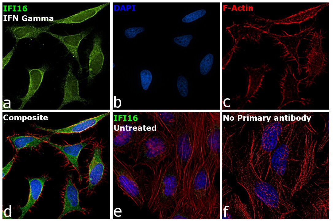 IFI16 Antibody (PA5-76462)