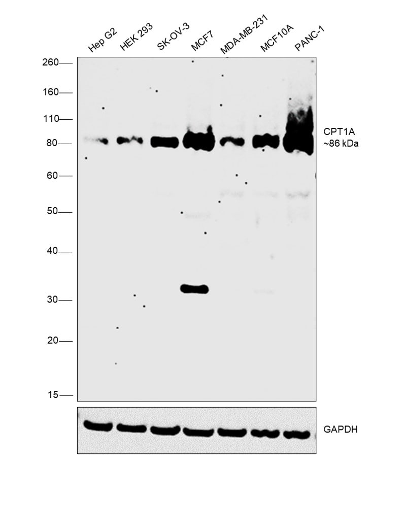 CPT1A Antibody (PA5-76788)
