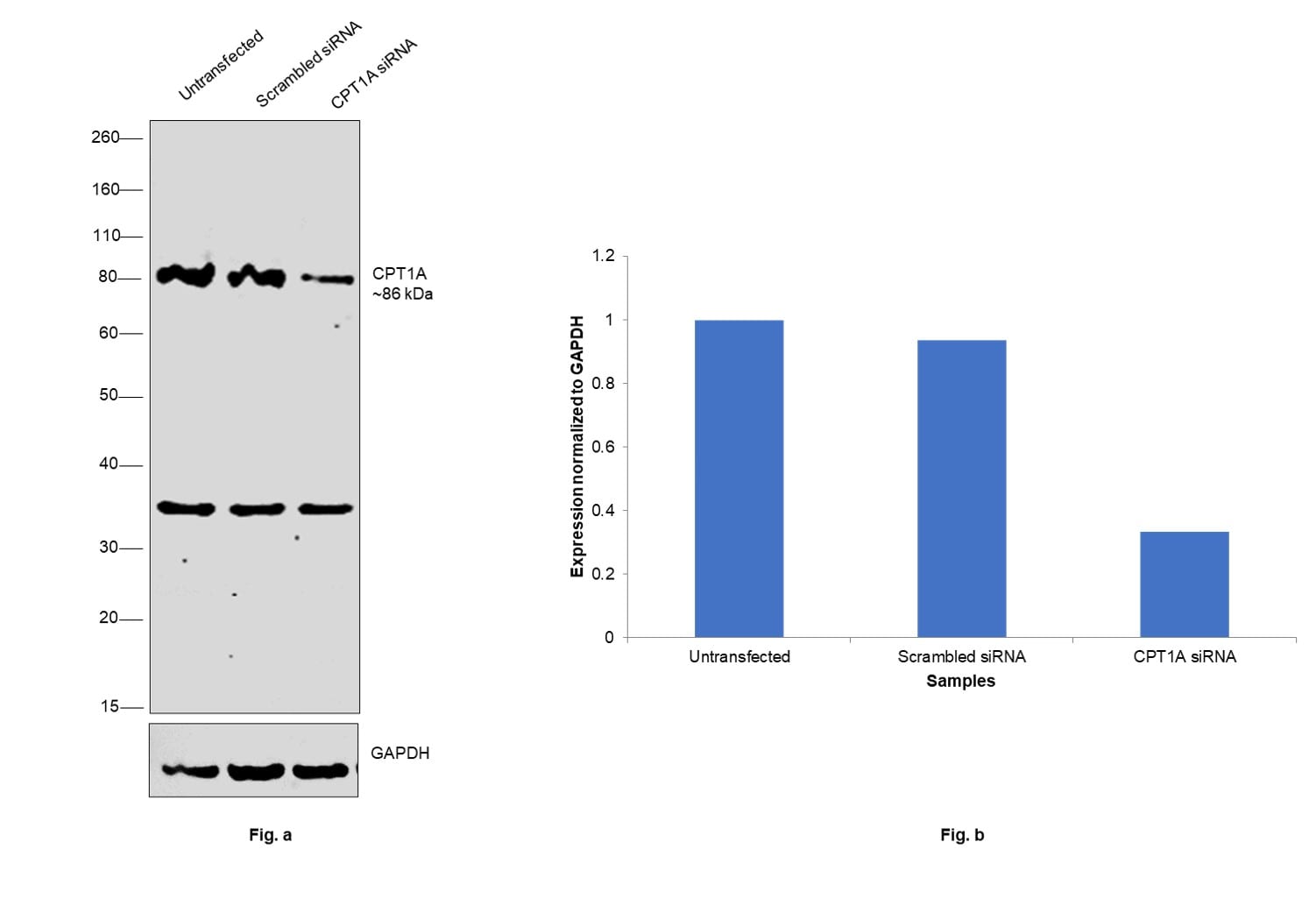 CPT1A Antibody (PA5-76788)