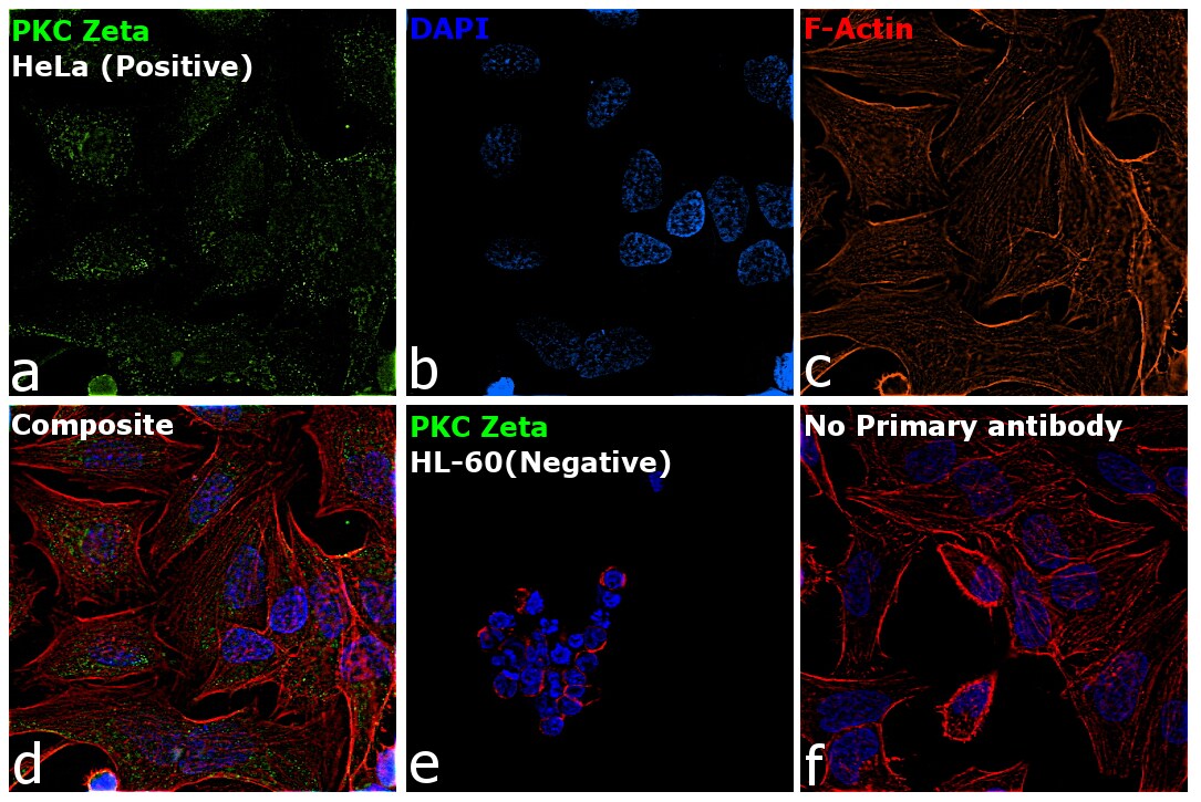 PKC zeta Antibody (PA5-78129)