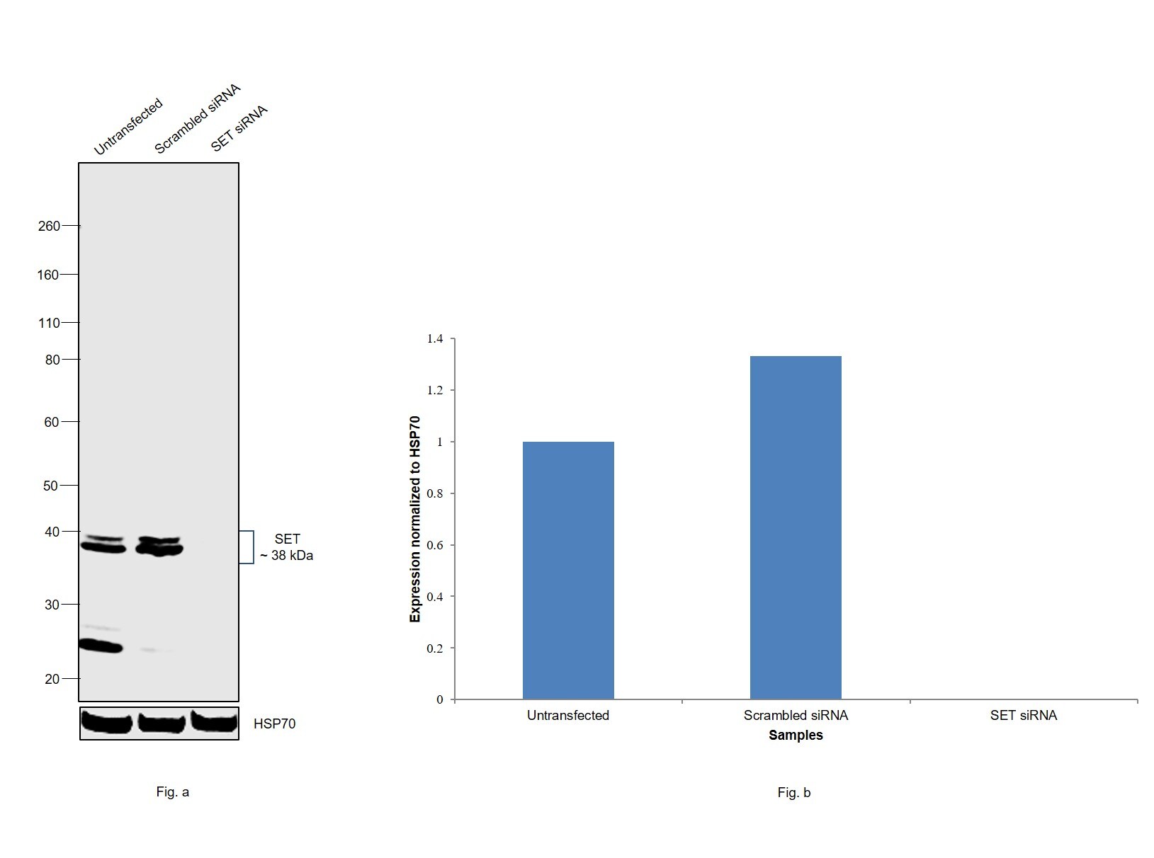 SET Antibody (PA5-78163)
