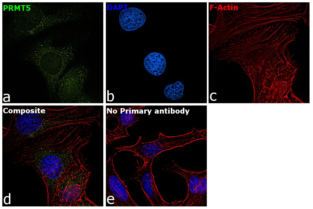 PRMT5 Antibody (PA5-78323)