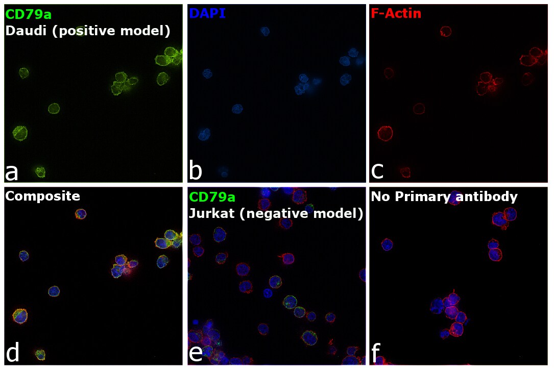 CD79a Antibody (PA5-78999)