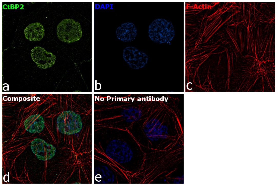 CtBP2 Antibody (PA5-79086)