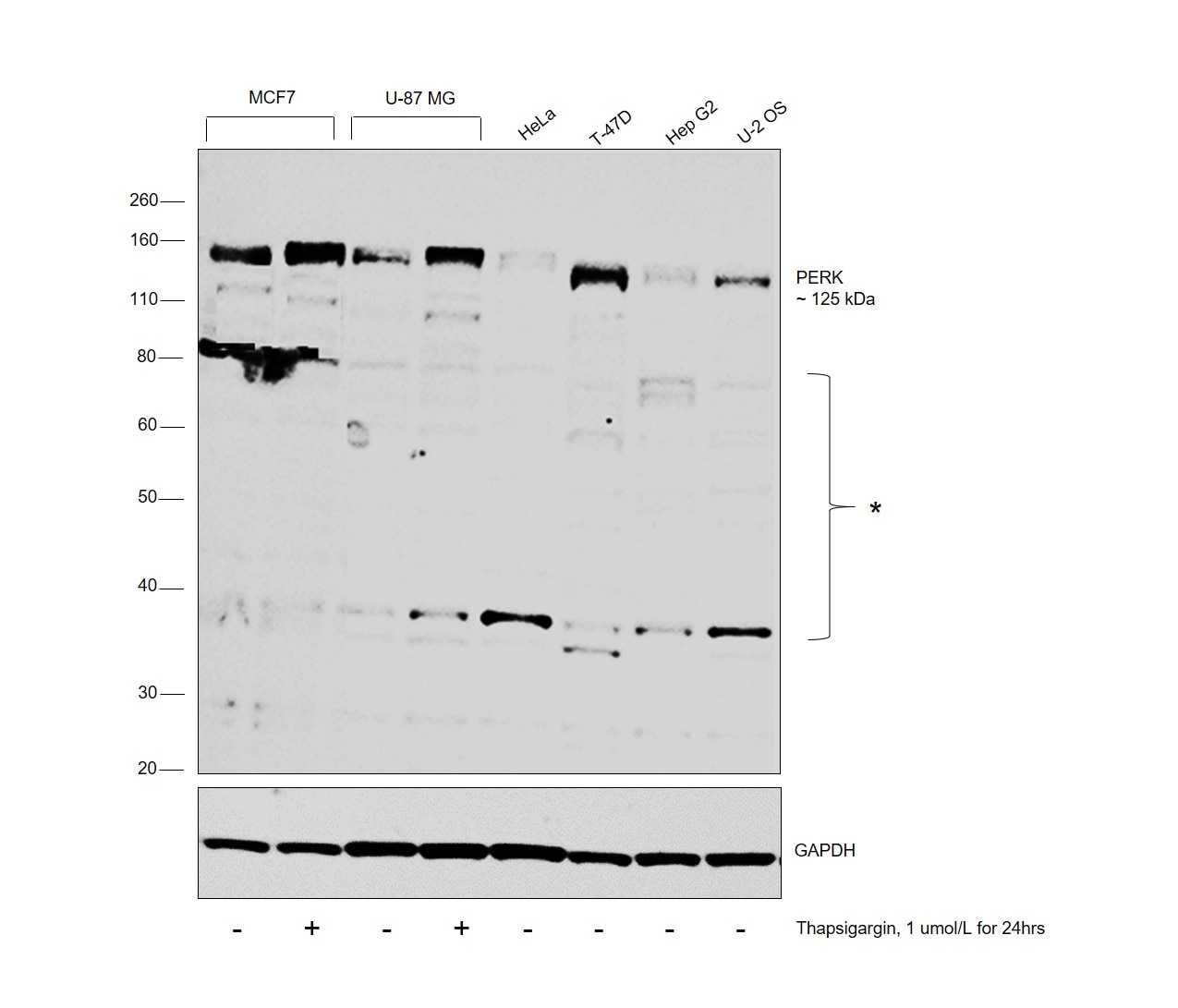 PERK Antibody (PA5-79193)