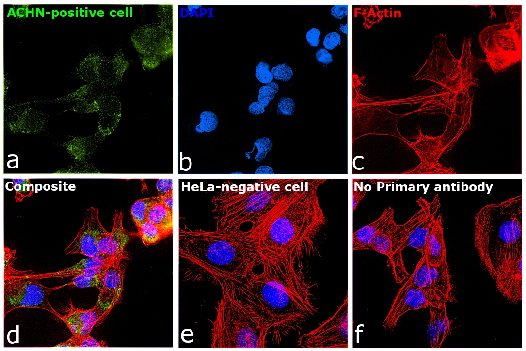 KIM-1 Antibody (PA5-79345)