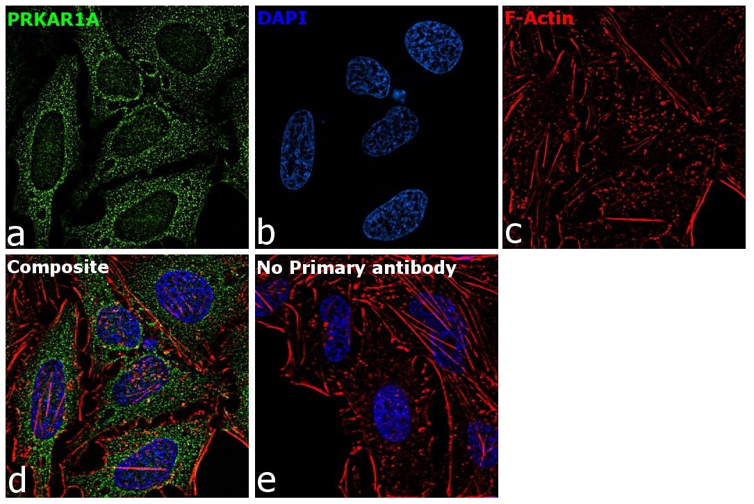 PRKAR1A Antibody (PA5-79867)