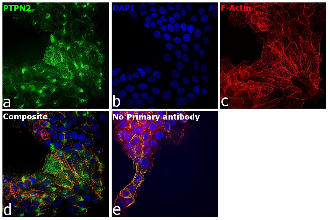 PTPN2 Antibody (PA5-79895)
