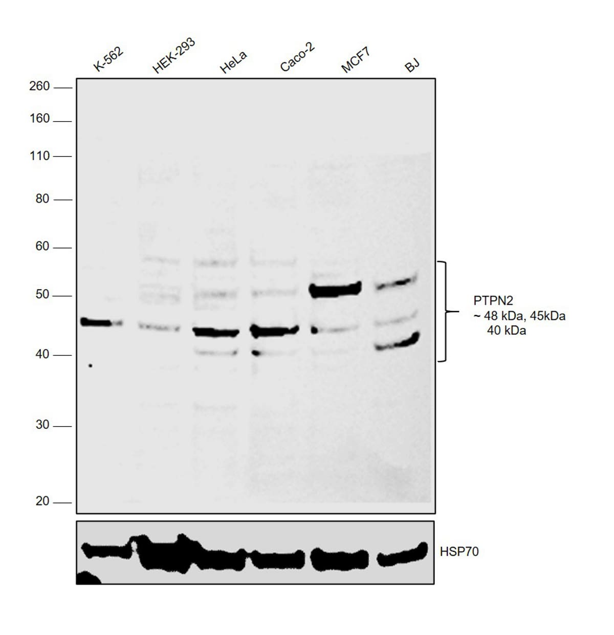 PTPN2 Antibody (PA5-79895)