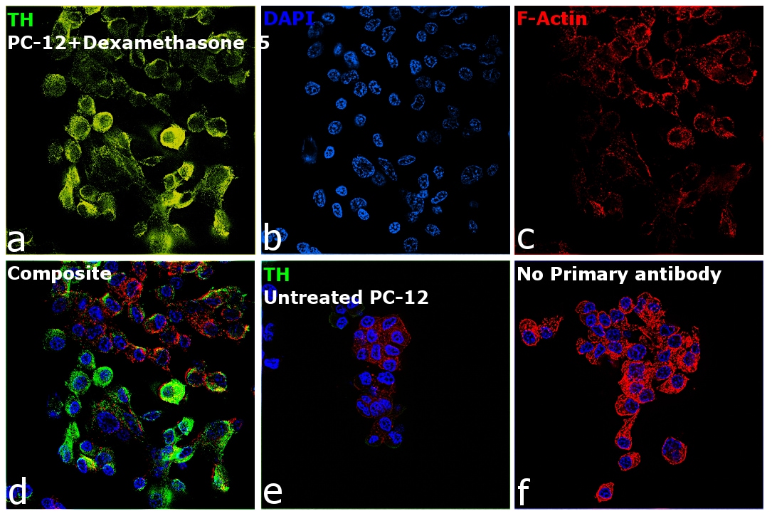 Tyrosine Hydroxylase Antibody (PA5-80120)