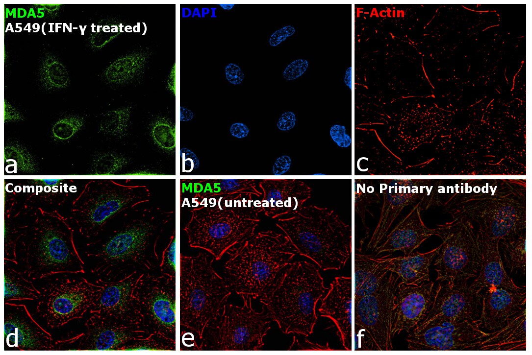 MDA5 Antibody (PA5-82028)