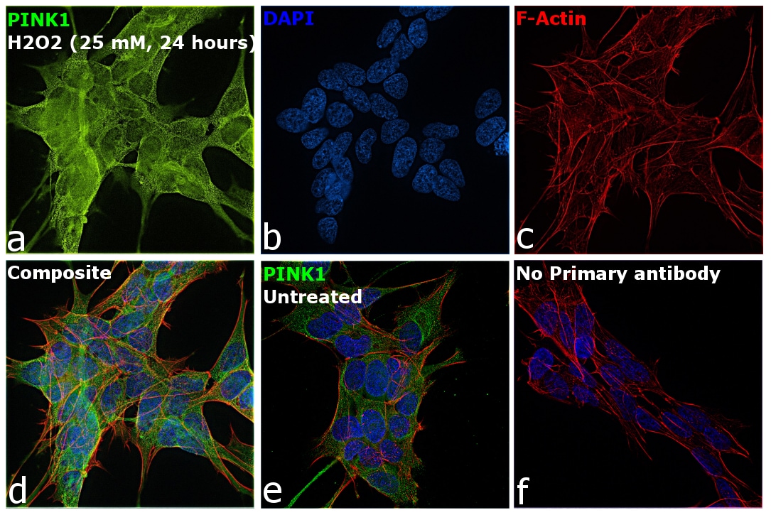 PINK1 Antibody (PA5-86941)