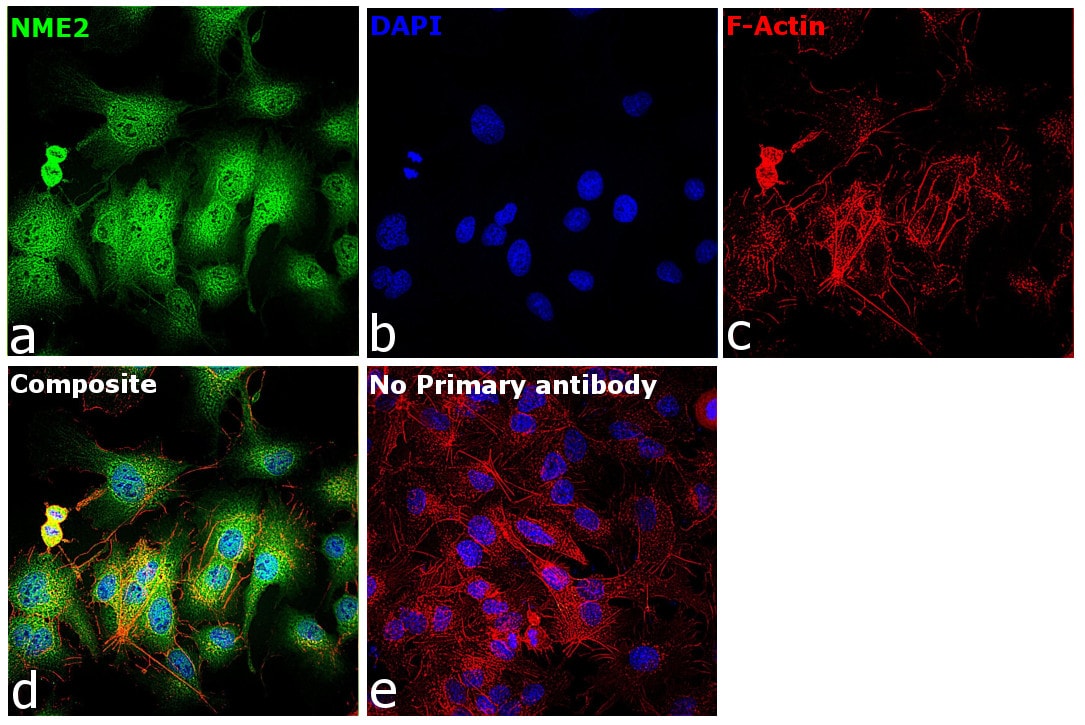 NME2 Antibody (PA5-96679)