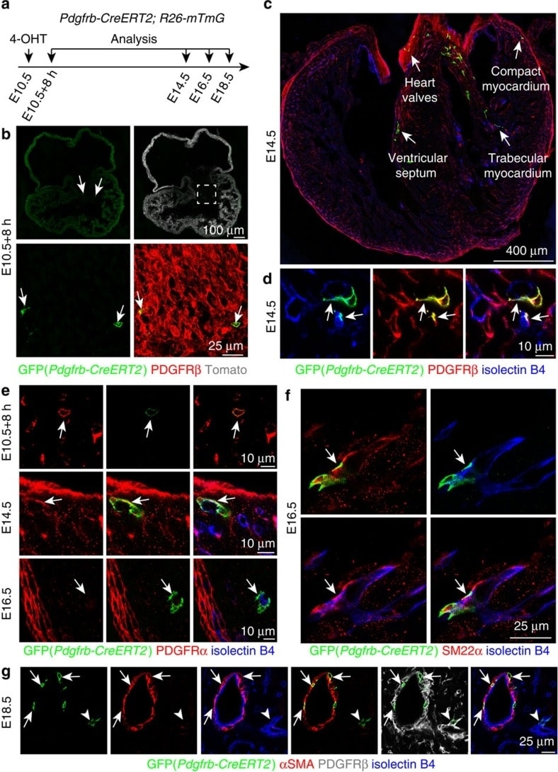 CD140a (PDGFRA) Antibody (14-1401-82)