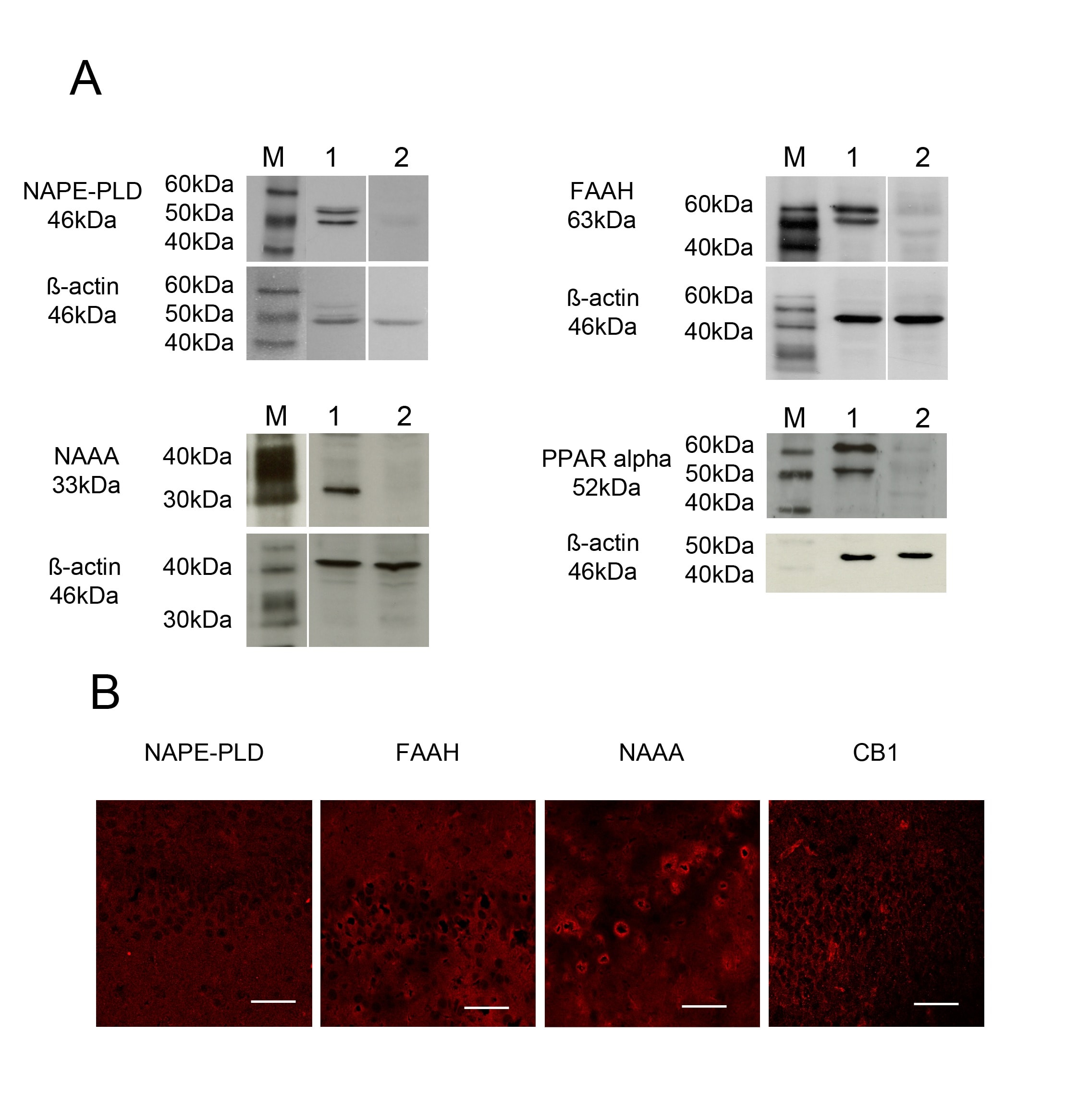 PPAR alpha Antibody (PA1-822A)